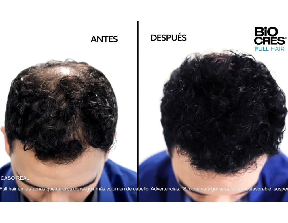 Biocres, prevenir es fortalecer